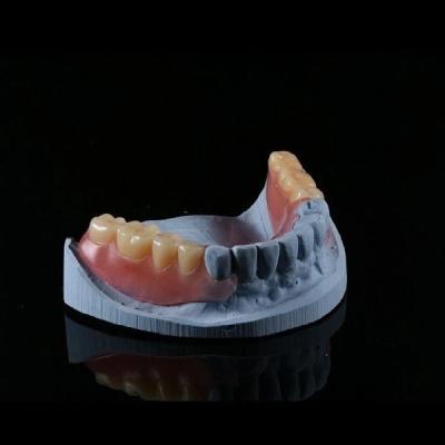 China Lightweight Flexible Valplast Partial Denture For Single Tooth for sale