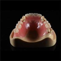 China Lightweight Flexible Valplast Partial Denture For Single Tooth for sale