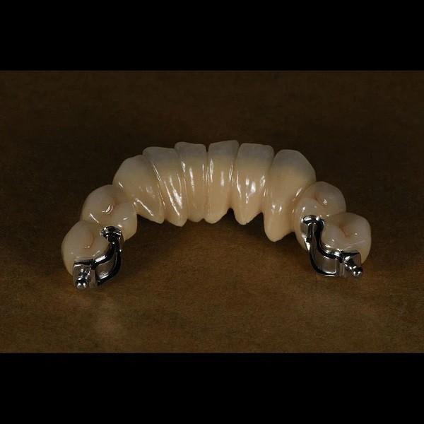 Quality Aesthetic Precision Dental Implant Ball Attachment Partial Dentures for sale