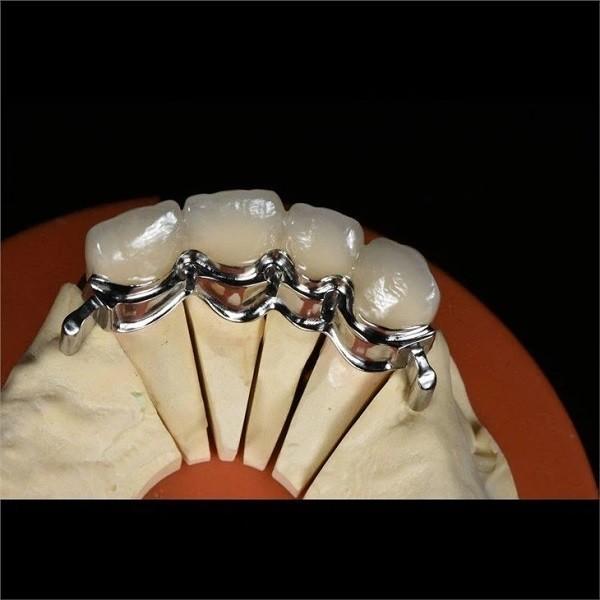Quality Aesthetic Precision Dental Implant Ball Attachment Partial Dentures for sale