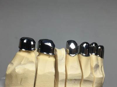 Quality ODM Dental Prosthesis Crown Telescope Precision Attachment Denture for sale