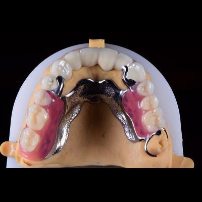 Cina Precisione Zirconia PFM corone protesi parziali aspetto naturale in vendita