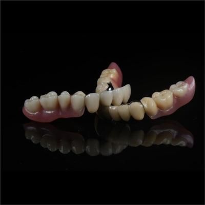 China Precision Zirconia PFM coroas dentaduras parciais aparência natural à venda