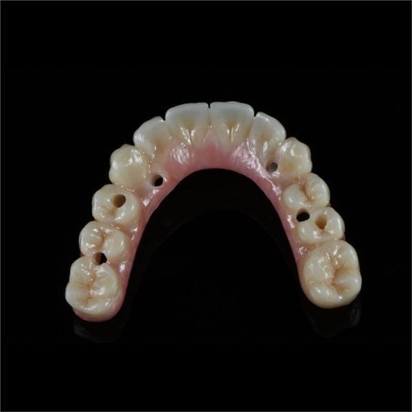 Quality Fixed Restorations Full Arch Zirconia Implant Bridge Denture Teeth for sale