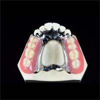 China Co Cr Biocompatibile Metal Cast Framework Partial Dentures ODM for sale
