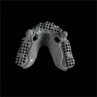 China OEM Peek Cast Metal Framework Partial Denture User Friendly for sale