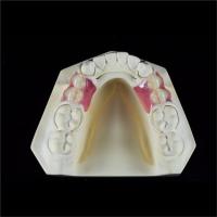 China OEM Peek Cast Metal Framework Partial Denture User Friendly for sale