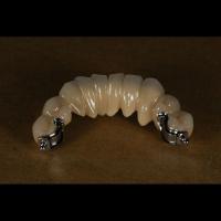 Quality Aesthetic Partial Denture Precision Attachments Medical Grade OEM for sale