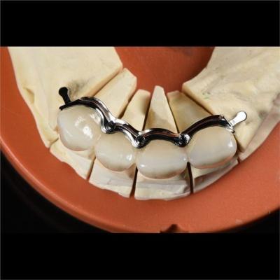 Cina Apparecchi di precisione per protesi parziali estetiche di grado medico OEM in vendita