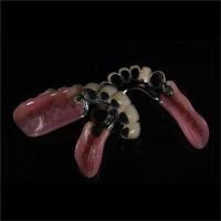 China Aesthetic Partial Denture Precision Attachments Medical Grade OEM for sale