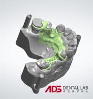 China ADS Dental Lab Partial Metal Frame Denture Framework Fabrication for sale