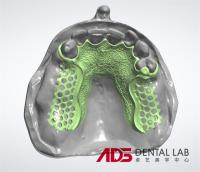 China ADS Dental Lab Partial Metal Frame Denture Framework Fabrication for sale