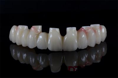 Cina All On 6 Impianto dentale in zirconia ponte a supporto a arco completo personalizzato in vendita