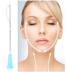 China Strong lifting korea long lasting effect 3d cog  pdo thread for face for sale