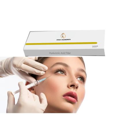 China 2019 cross linked hyaluronic acid gel 1ml dermal filler for lip and face for sale