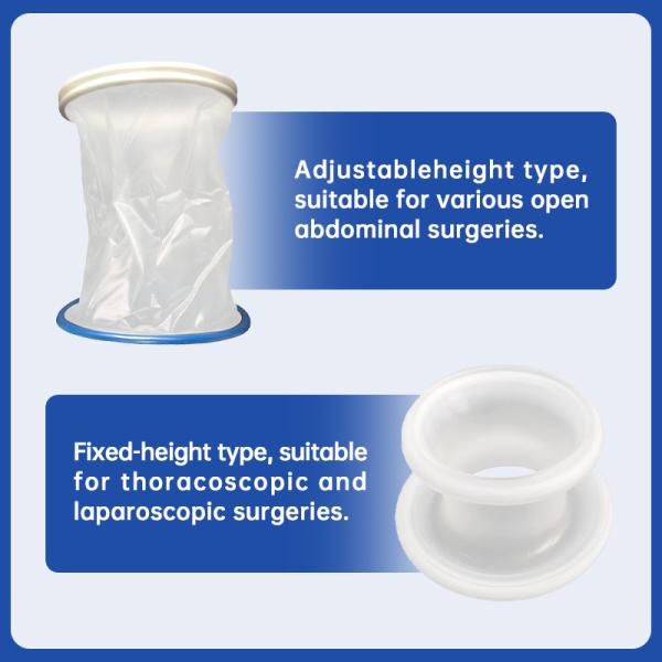 Quality Adjustable Height Incision Protector Disposable Surgical Wound Retractor Fixed Options for sale