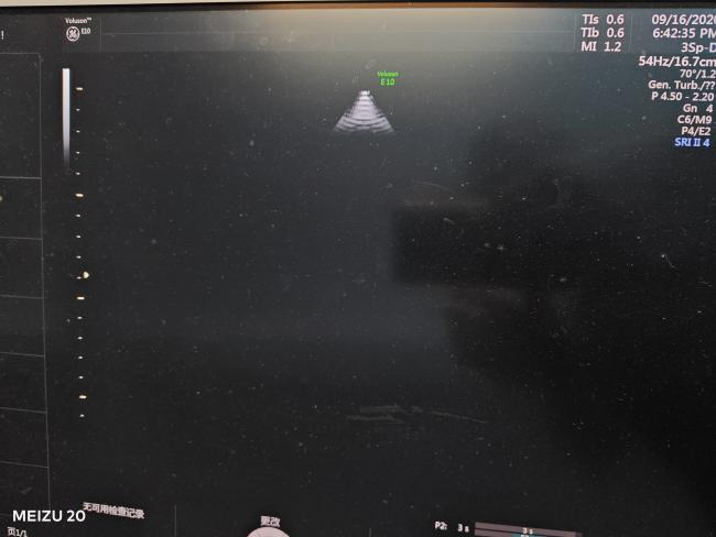 GE VolusonE8 3SP-D phased array ultrasound transducer probe