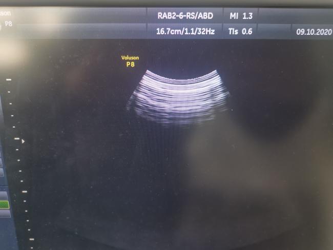 GE VolusonS10 RAB2-6-RS 3D/4D ultrasound transducer