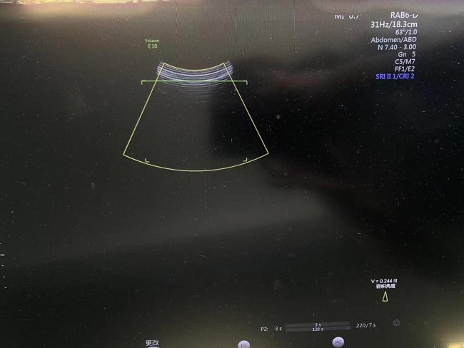 GE Voluson E6 RAB6-D 3D/4D ultrasound probe front view