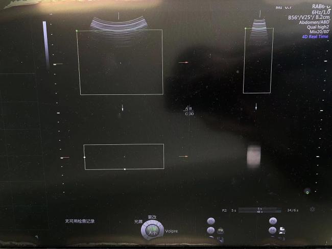GE Voluson E6 RAB6-D 3D/4D ultrasound probe side view