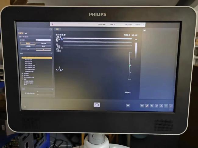 L12-5 Linear Array Ultrasound Probe for ATL EPIQ Affiniti CX50