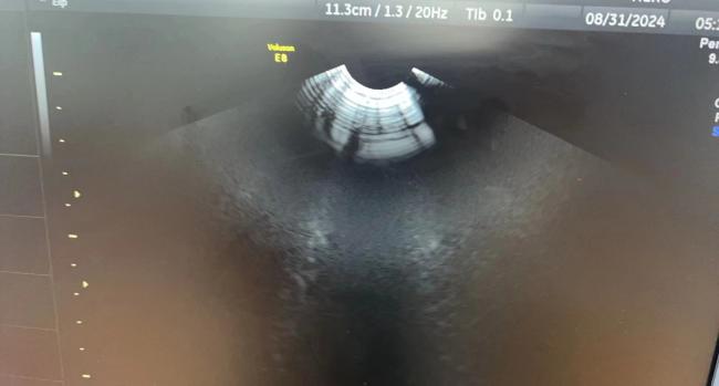 GE LogiqS7 S8 3D/4D Transvaginal Probe RIC5-9A-RS
