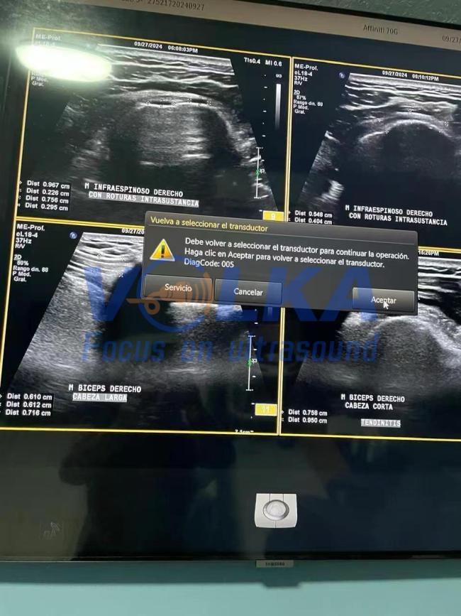 ATL EL18-4 ultrasound probe undergoing repair process