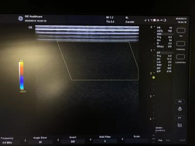 China GE VividE Sonda de Ultrassonografia Linear Original 9L-RS, Transdutores de Ultrassonografia GE 3,3-10,0 MHz à venda