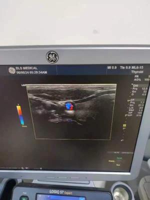 China Original Linear Array Ultrasound Machine Probes ML6-15 For GE LogiqP6 Ultrasound for sale