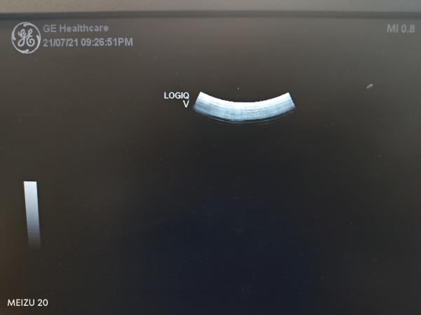 Quality Original Ultrasound Transducer Crystal 4C-RS High Image Quality for GE VividS6 for sale