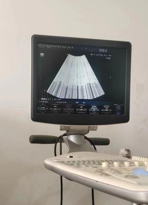 China Reparação Hitachi Aloka F37 TX Ultrassom Máquina Peças Board EP557400 à venda