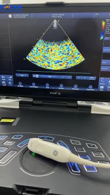 중국 GE VividIQ VIVIDS5 단계 배열 원초 초음파 탐사 12S-RS 판매용