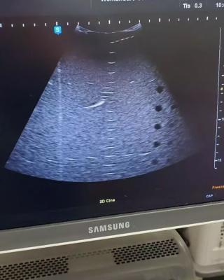 중국 삼성 메디슨 H60 굽은 배열 원본 초음파 탐사 CF2-8 판매용