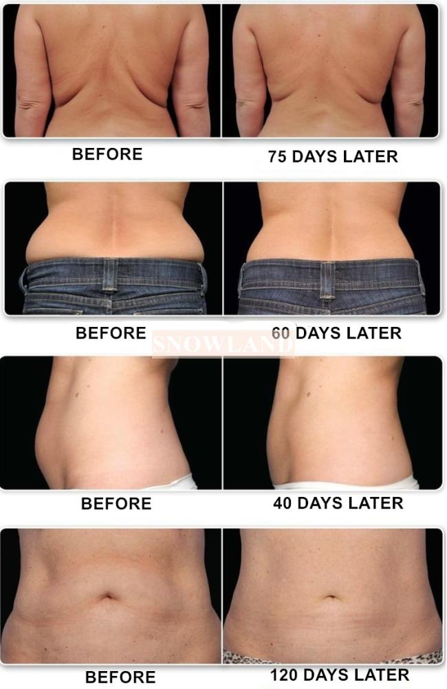body slimming machine.jpg