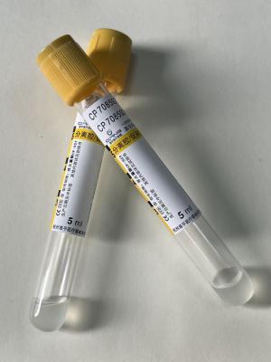 China Serum Separator Tube (SST) with Clot Activator & Gel Barrier for sale