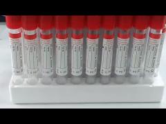 1ml - aprobación del CE de los tubos del drenaje de la sangre del top de la lavanda 10ml para el análisis del glóbulo