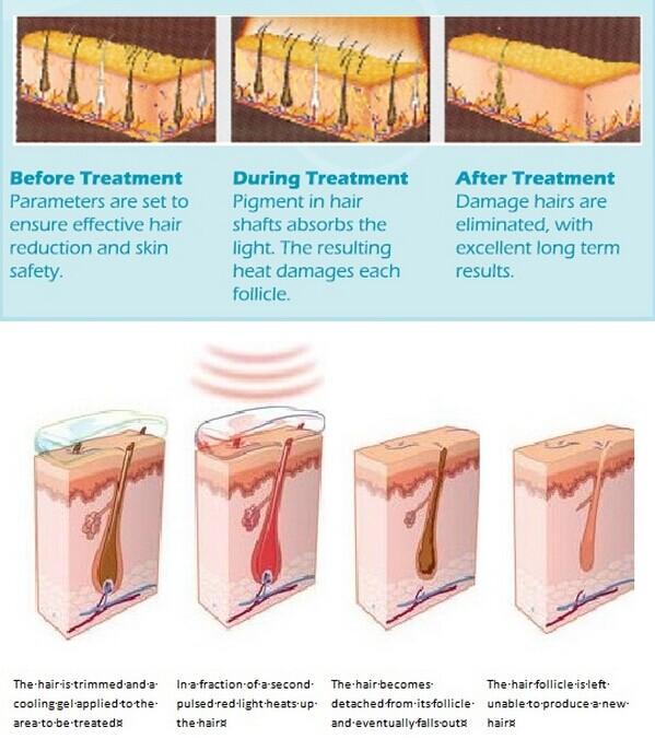 WOW!!! beauty salon use!!!! 3 handles ipl hair removal / ipl machine / ipl handpiece
