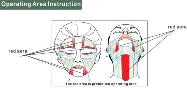 hifu verticale per pelle che tighting