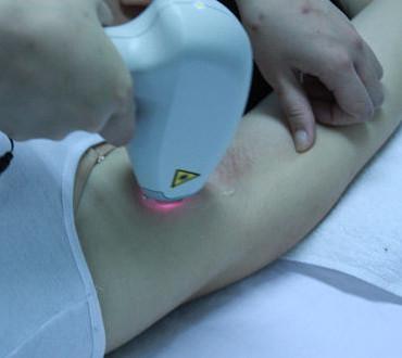 China Pain Free Permanent Hair Removal Device , 808 Nm Skin Rejuvenation Machine for sale