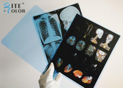 China Inkjet Medical Imaging Film X Ray Radiology Film 8 * 10 Inch A4 A3 215 Micron Thickness for sale