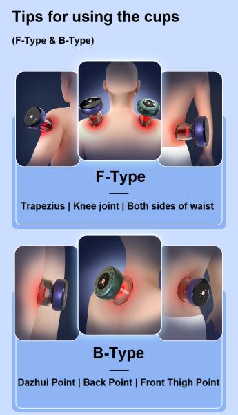 Quality Trend Vacuum Cupping Therapy Set Class II Body Cupping Cups with OEM ODM Hijama for sale