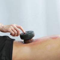 China Class II Fitdash Intelligent Smart Cupping Device Vacuum Cupping Therapy Machine for sale