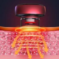 China Fitdash Electric Cupping Therapy Machine High Frequency Vibration and Strong Suction for sale