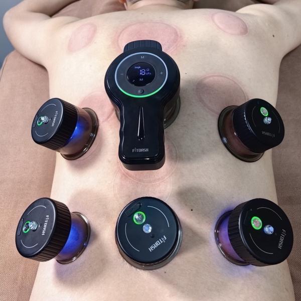 Quality Intelligent Breathing Cupping with -10kPa--60kPa Suction Strength and 3.7V for sale