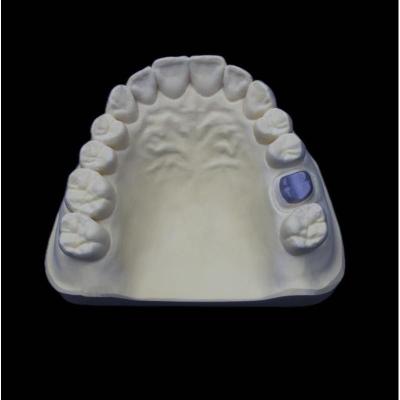 China Post And Core Dental Inlay Core For Enhanced Tooth Stability Restoration Anchorage for sale