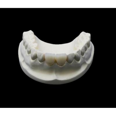China Translucency E Max Crown Lithium Disilicate Crown High Strength And Biocompatible for sale