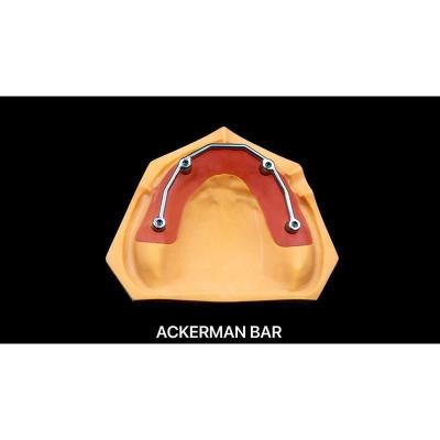 China Customization Milling Abutment Dental Implants Precision Fit And Enhanced Aesthetics for sale