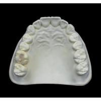 Quality Minimally Invasive Dental Composite Inlay Posterior Teeth Restoration for sale