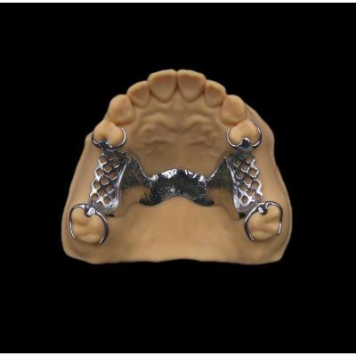 China Biocompatible Dental Metal Framework Precision Fit Durability Framework Dental for sale