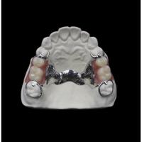 China Biocompatible Dental Metal Framework Cobalt-Chromium Titanium Precision Fit for Removable Partial Dentures for sale